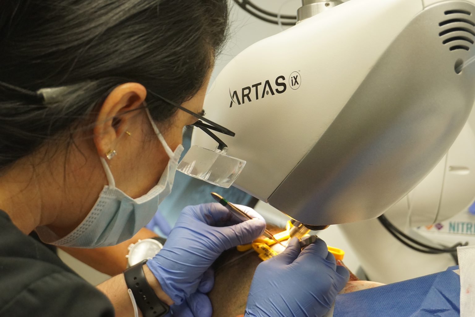 ARTAS® Hair Robotic Technology - Miami Hair Institute