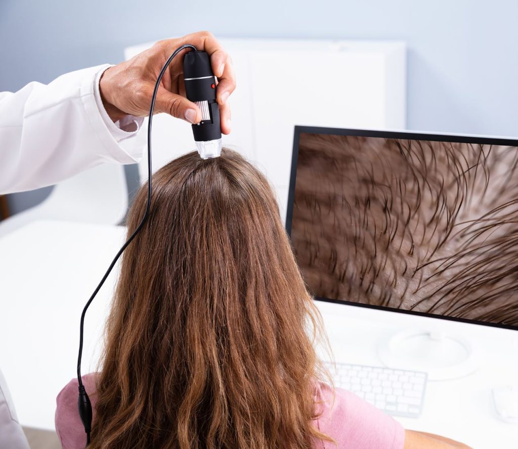 Hair Loss Evaluation and Treatment | Miami Hair Institute