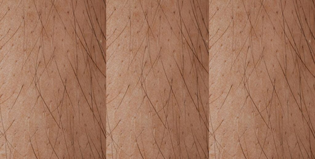 Body Hair Transplants: Success Rates, Pros, and What to Expect